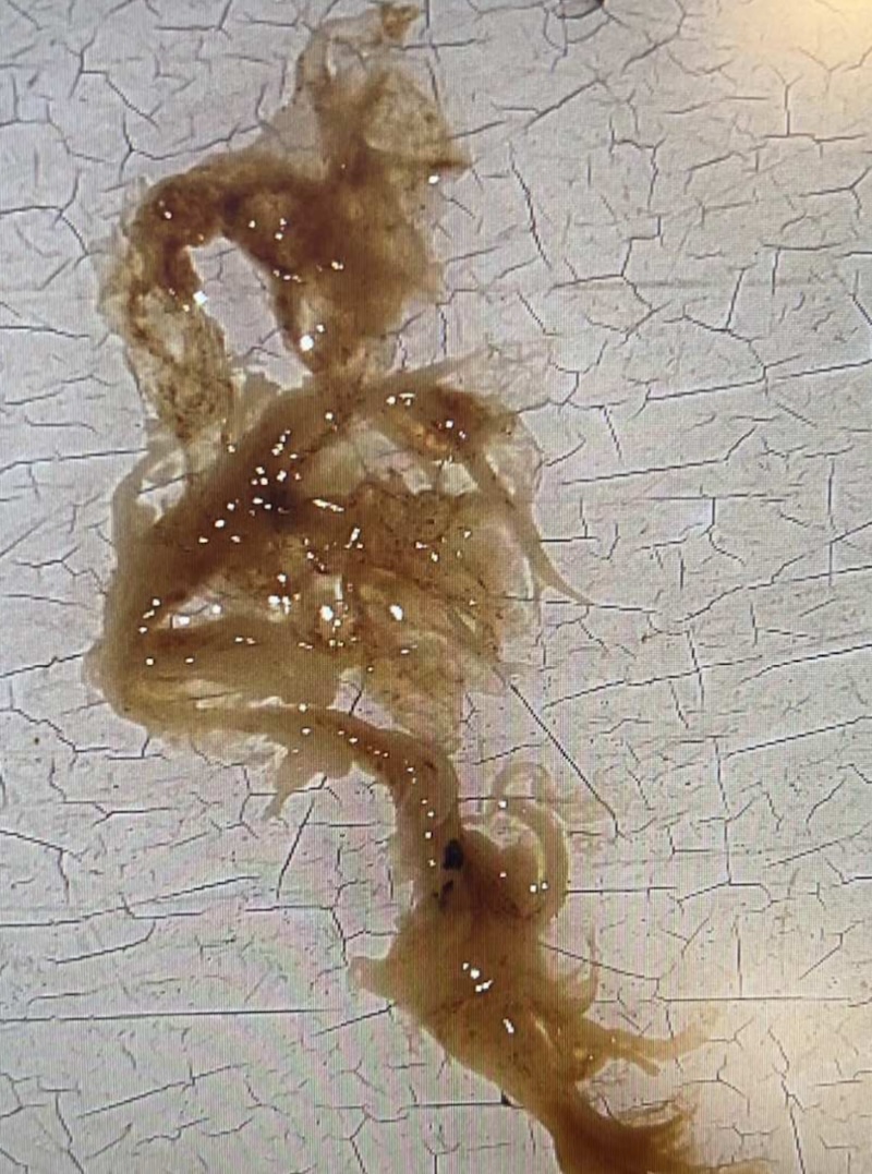 Parasite Cleansing Guide and eBook - Sunshine Holistic Health