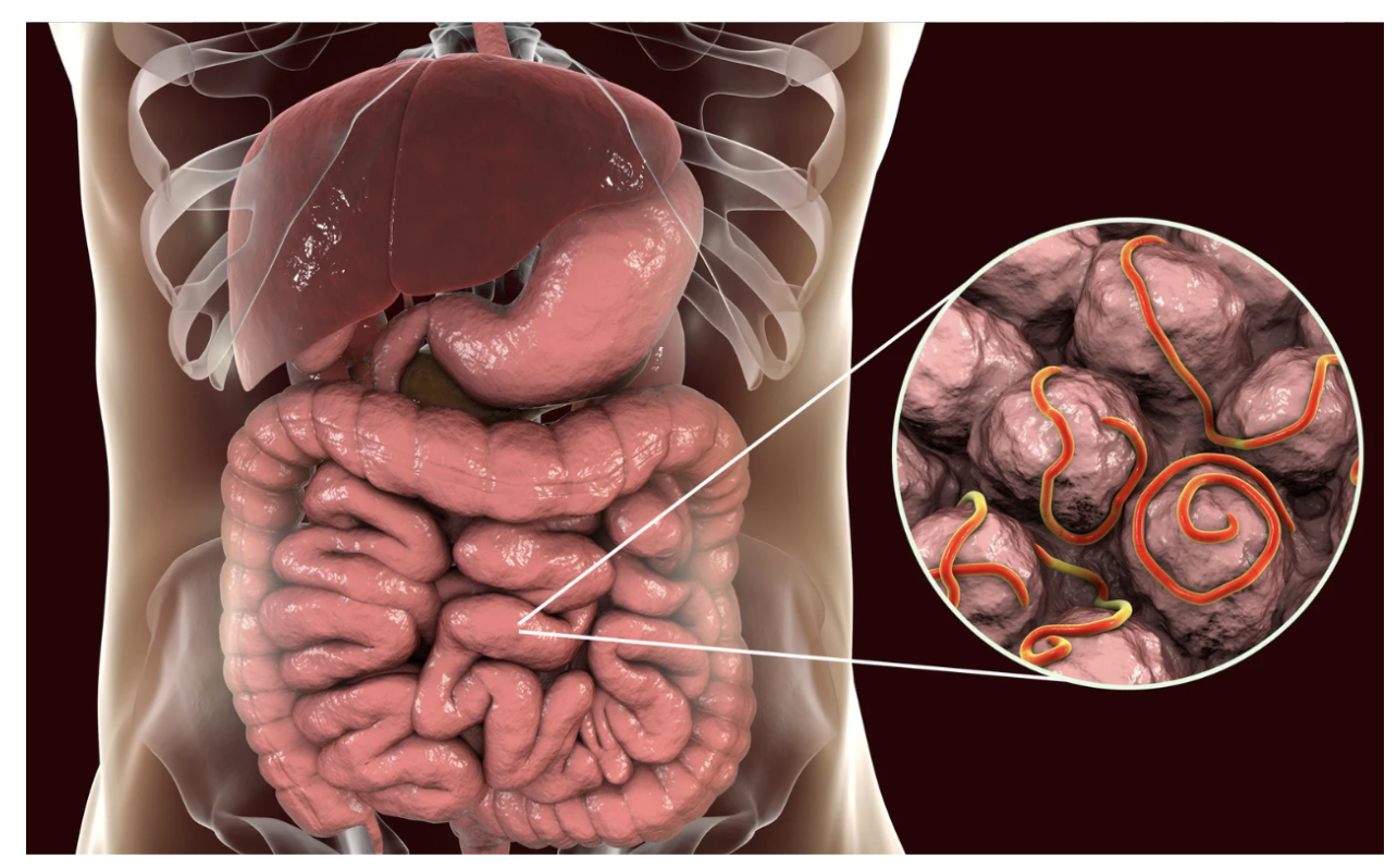 Parasite Cleansing Guide and eBook - Sunshine Holistic Health